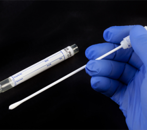 cultures - Sinus Relief Goshen NY